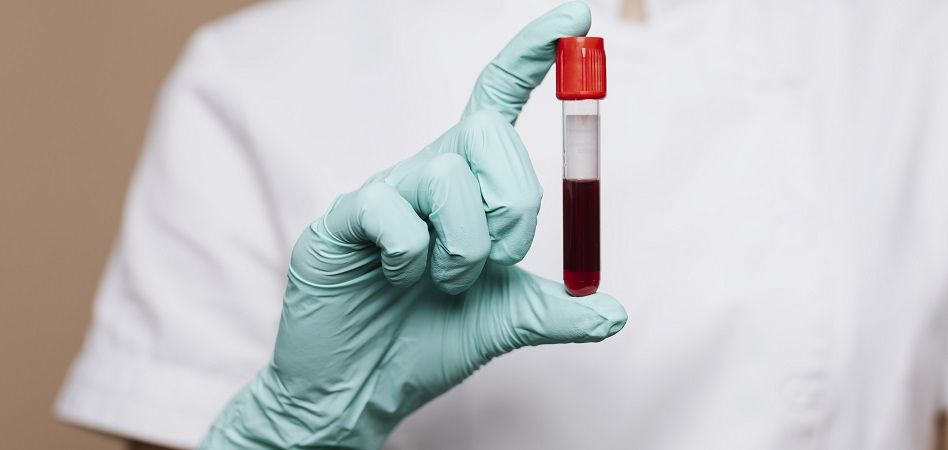 Loopdx busca medio millón de euros para sacar al mercado su biomarcador ...